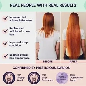 Moerie | Hair | Moerie Ultimate Hair Growth Spray Designed To ...